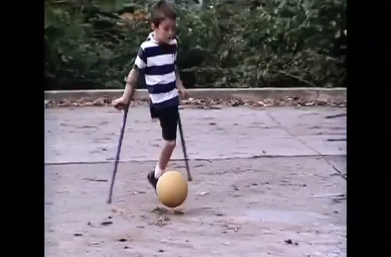 This one-legged soccer star will make you never complain again.