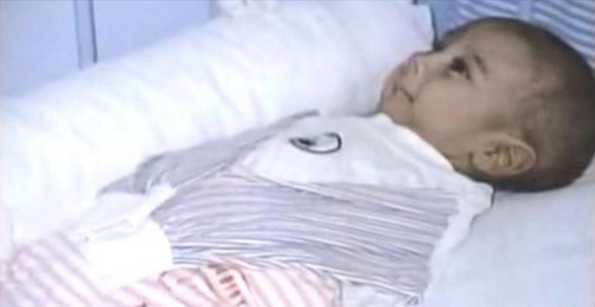 Baby born without arms or legs gets happy ending.