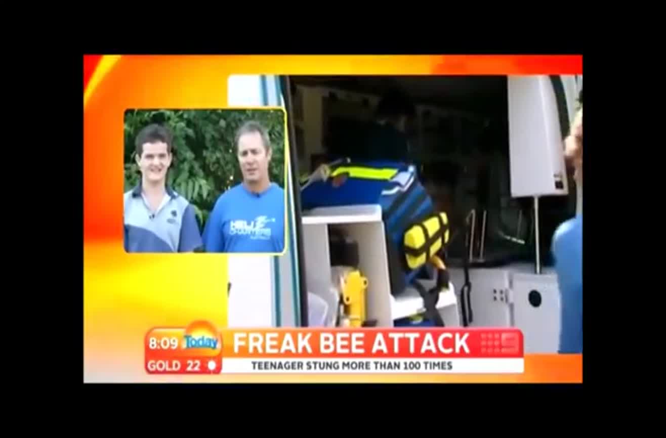 Dad gives a funny response when asked about his son's bee attack.