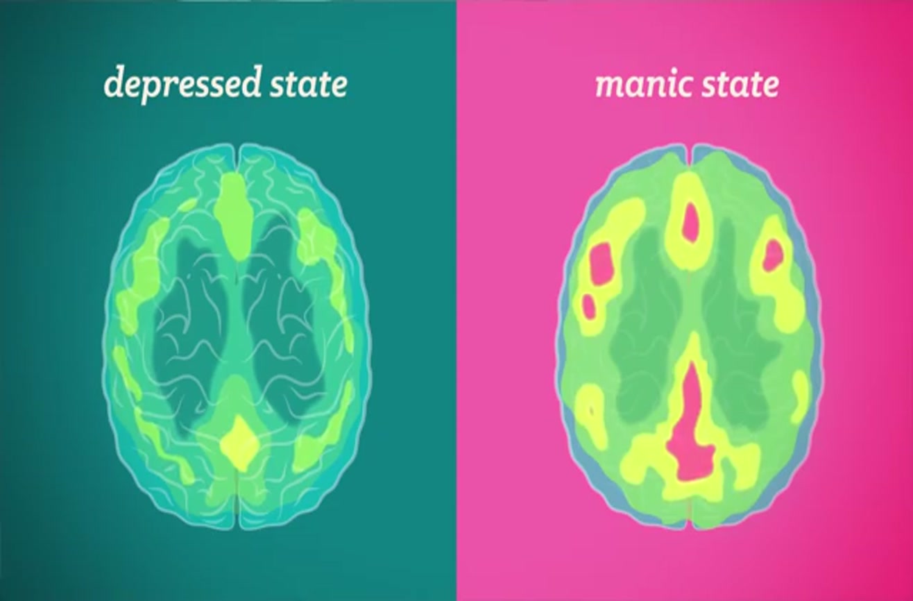 A crash course explanation on mood disorders.