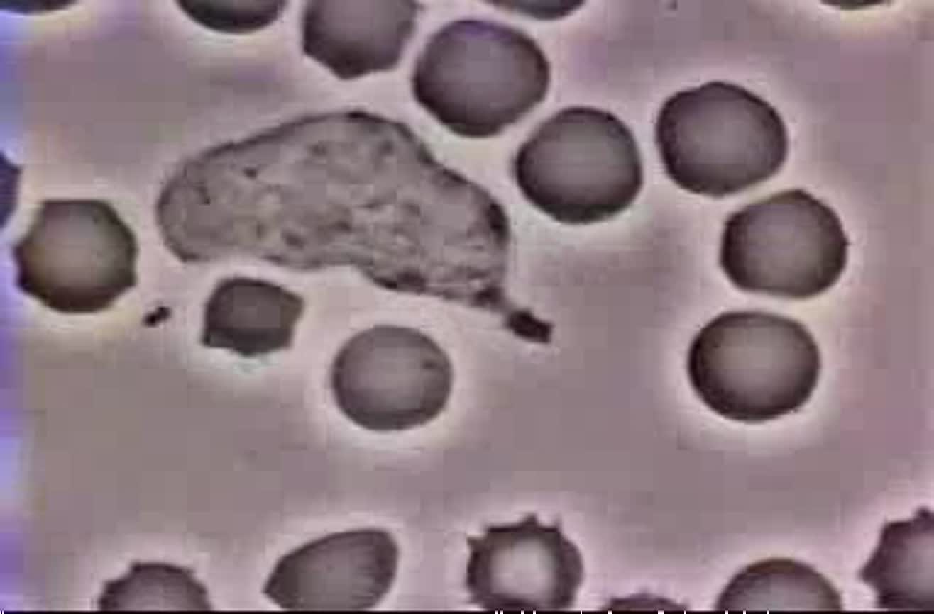 White blood cell chases bacteria, eats it.