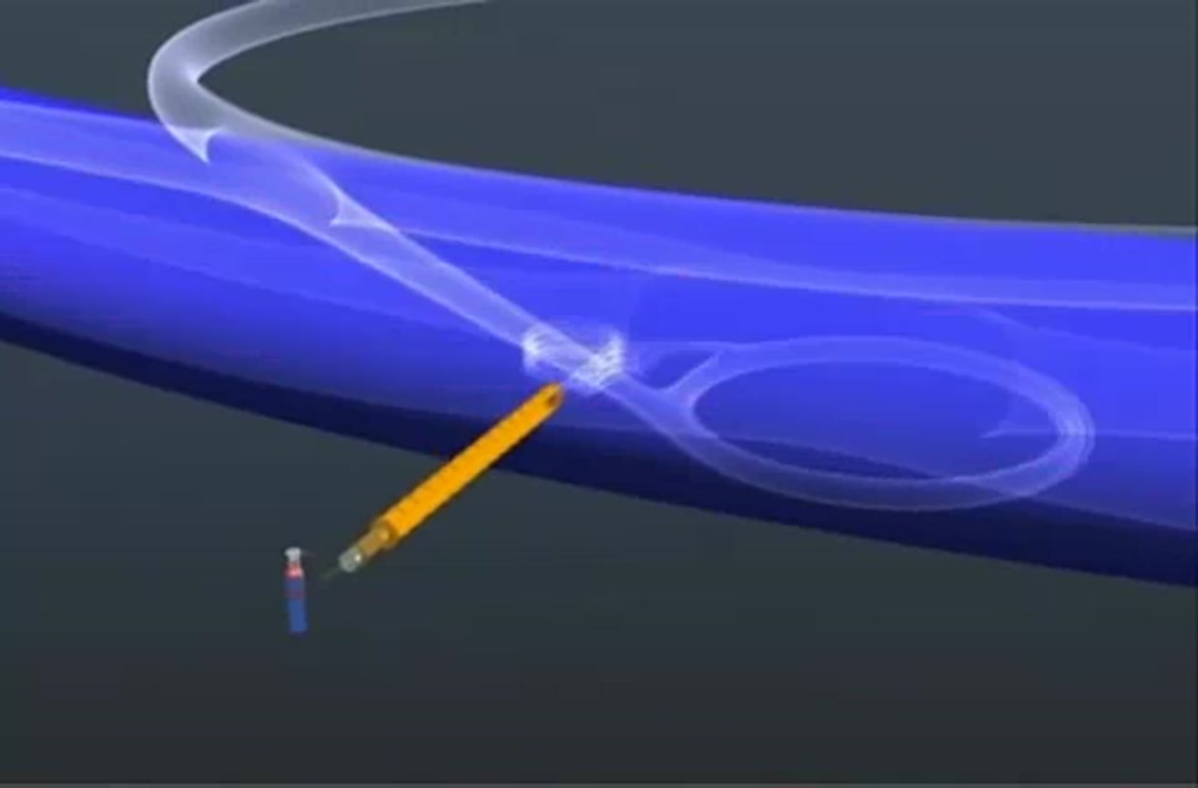 How it works: Large Hadron Collider machine.