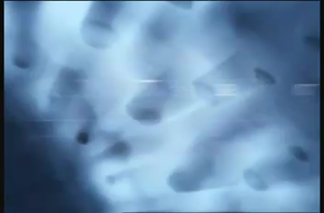 HIV replication: 3D medical animation.