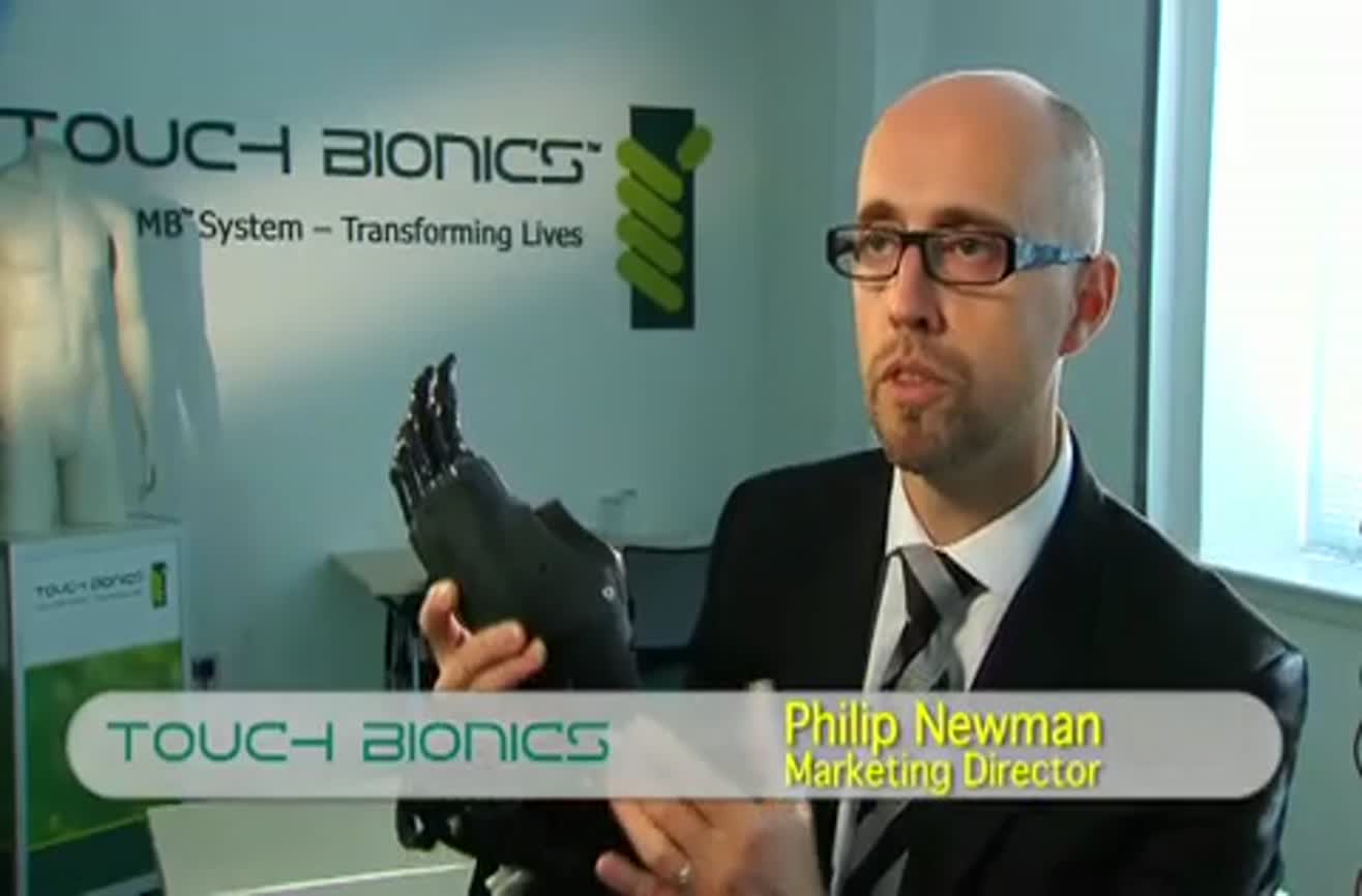 World's first bionic finger.