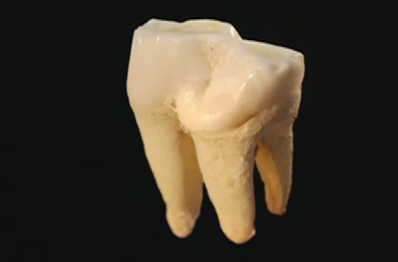 Amazing: Tooth magnified to the extreme.