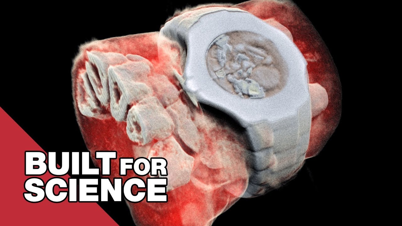 The world's first 3D, color X-ray