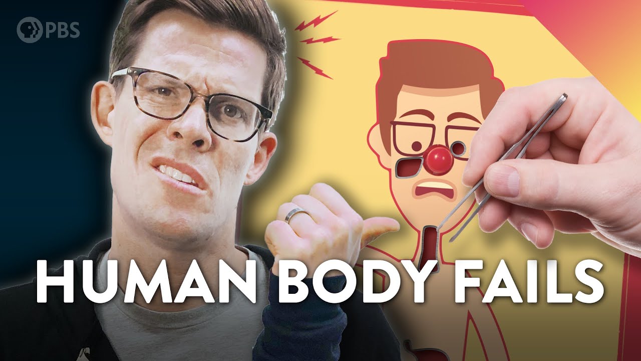 Classic human body fails.