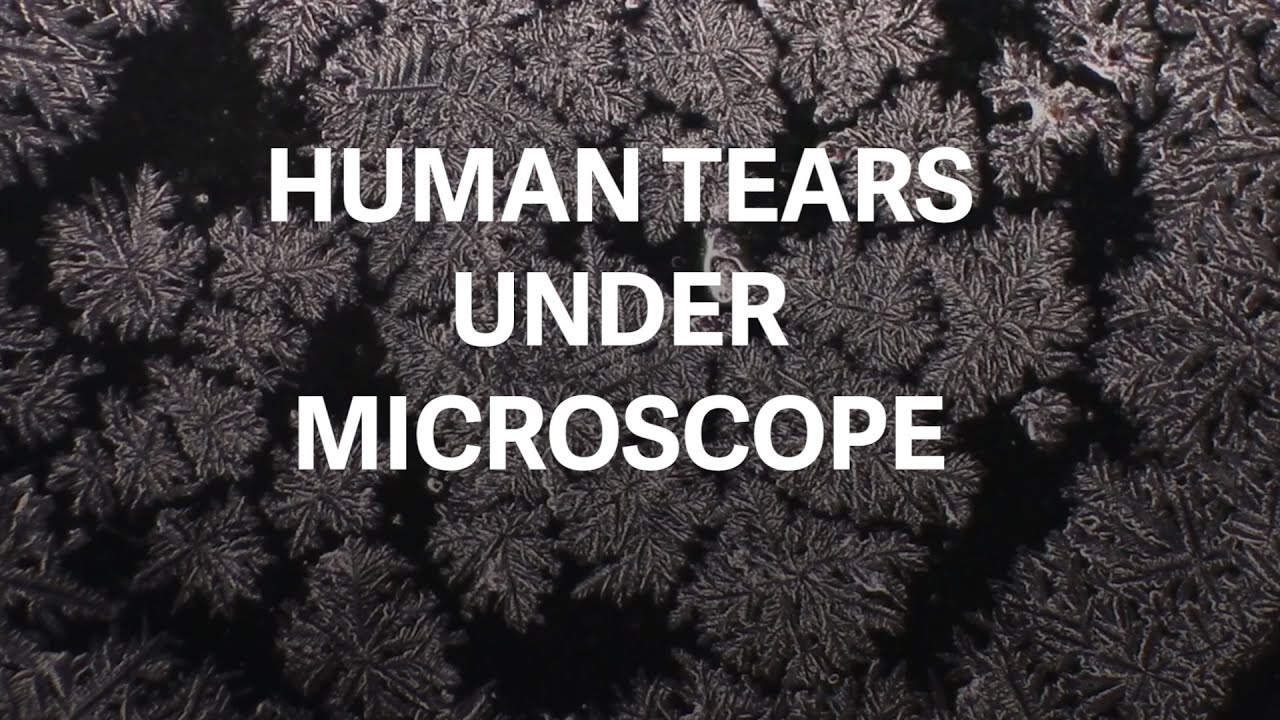 The microscopic beauty of our tears.