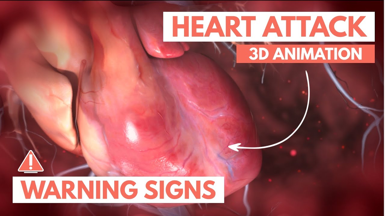 Quickly recognize signs of a heart attack.