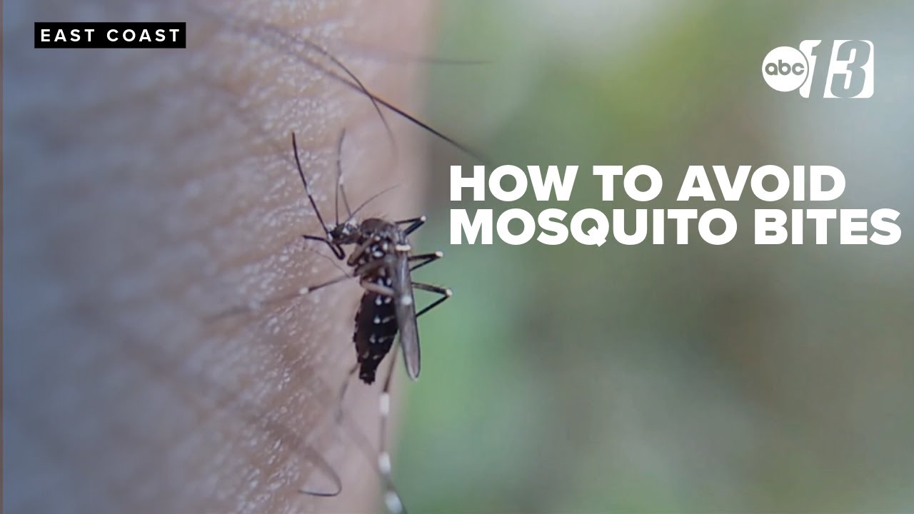 Are certain people really Mosquito Magnets? Are certain people really Mosquito Magnets?