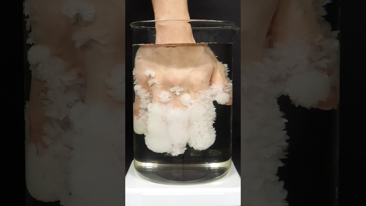 Freezing my hand in hot ice.